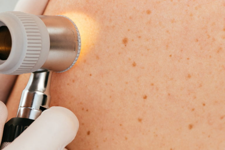 Efudix – Skin Search